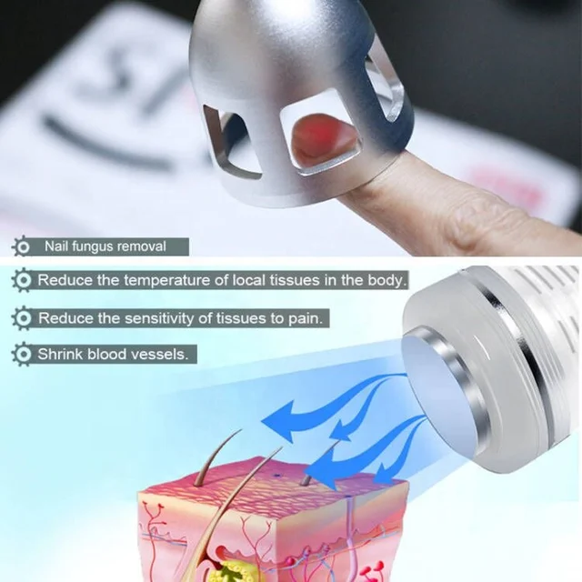 blood vascular cleaning vascular removal laser beauty device · Renee ...